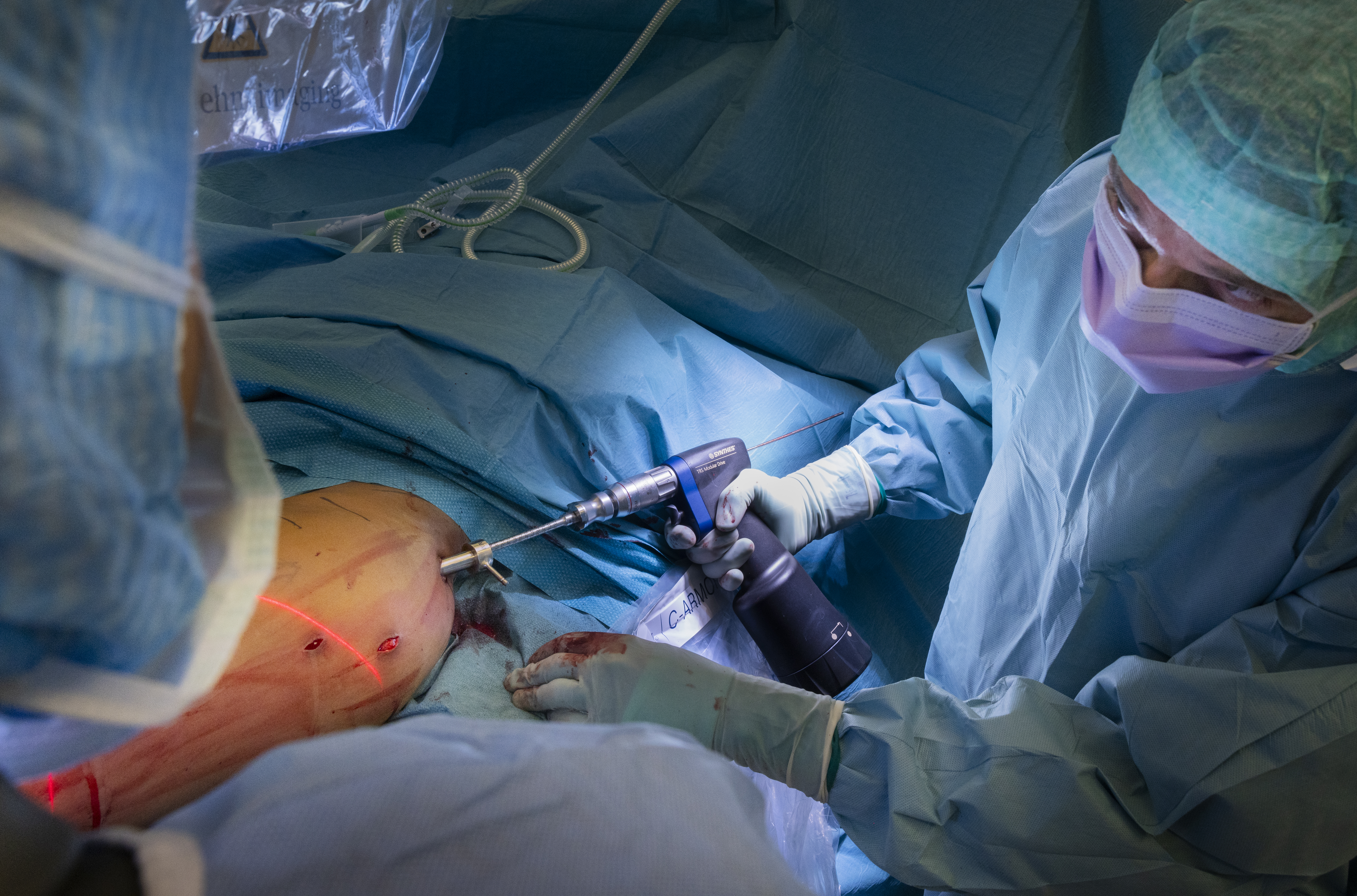 Operasjoner for personer med en sjelden bensykdom - Sunnaas sykehus HF