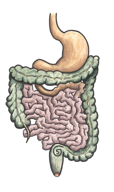 Medisinske forhold ved ryggmargsbrokk - Sunnaas sykehus HF